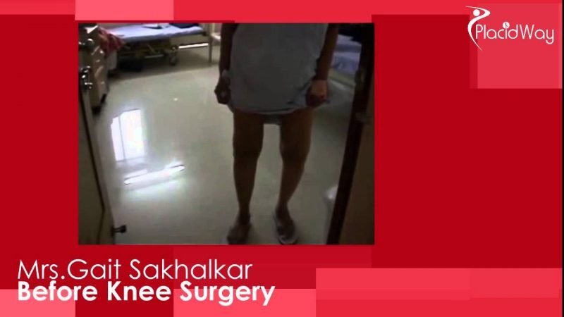 Knee Replacement in Istanbul Turkey
