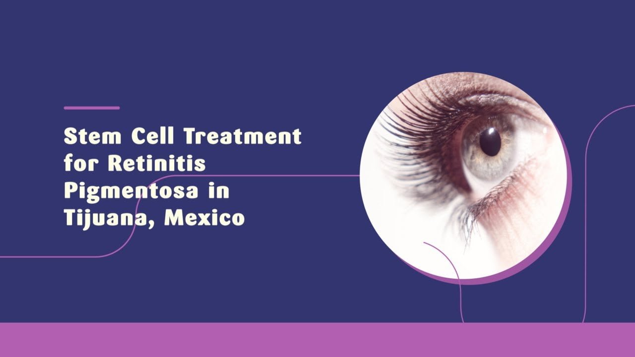The Most Affordable Stem Cell Treatment for Retinitis Pigmentosa in ...